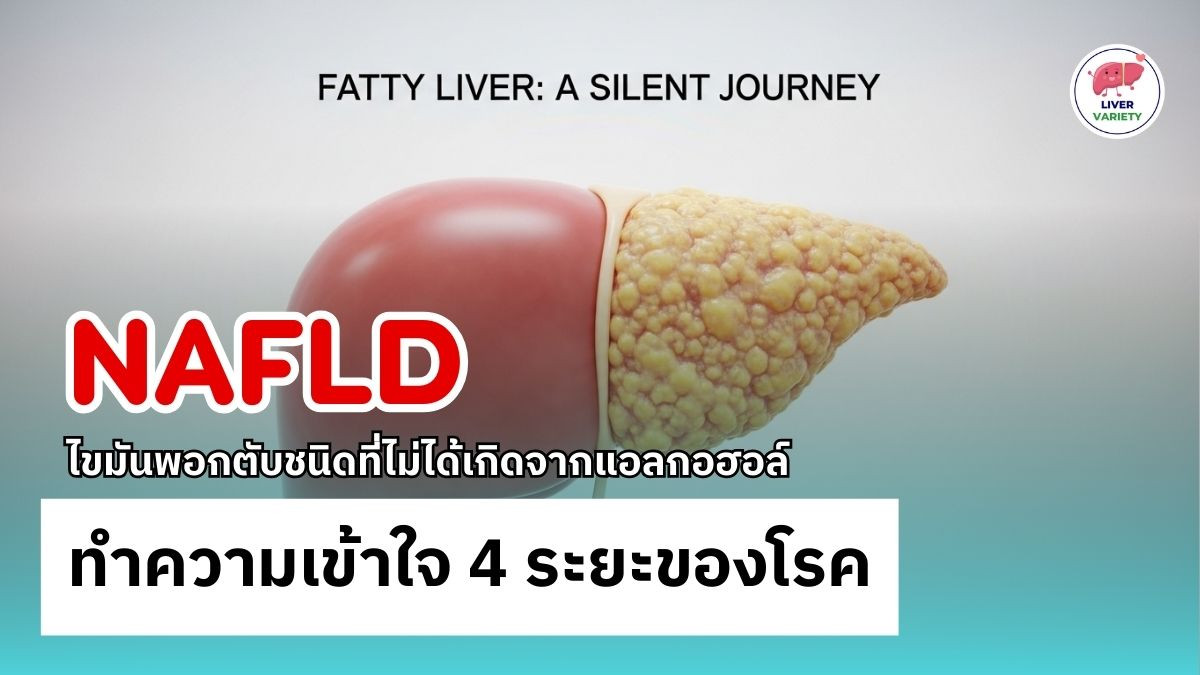 ทำความเข้าใจ 4 ระยะของโรค: NAFLD ไขมันพอกตับชนิดที่ไม่ได้เกิดจากแอลกอฮอล์